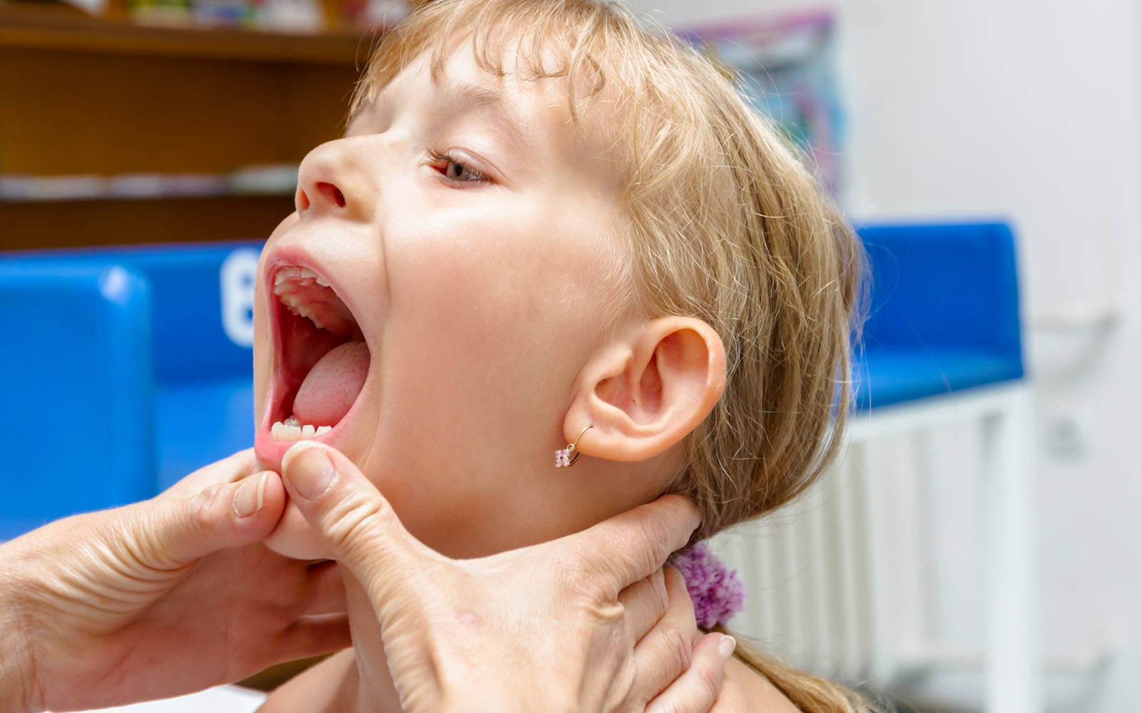 Mandeln entfernen: Wann ist es sinnvoll?